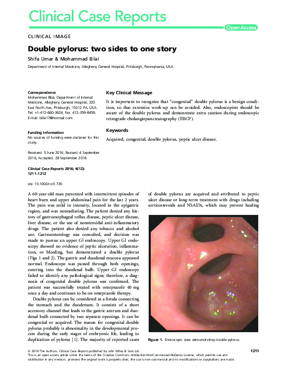 (PDF) Double pylorus: two sides to one story