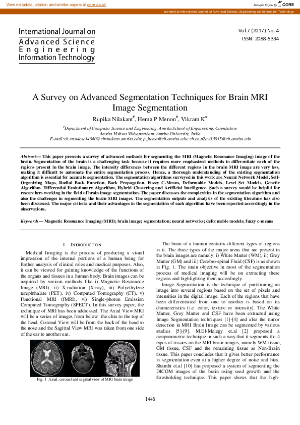 (PDF) A Survey on Advanced Segmentation Techniques for Brain MRI Image Segmentation
