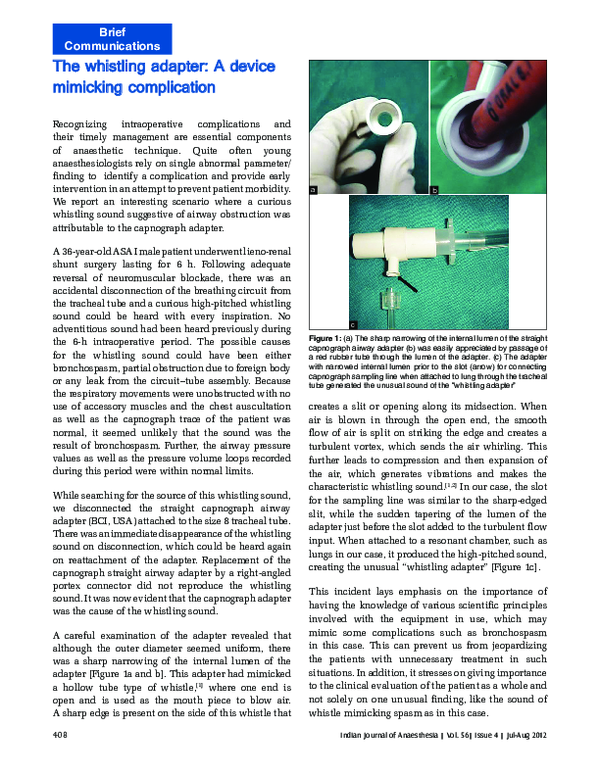 (PDF) The whistling adapter: A device mimicking complication