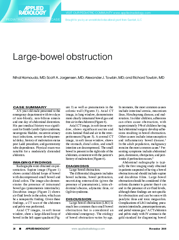 (PDF) Large-Bowel Obstruction in a Child Case Study
