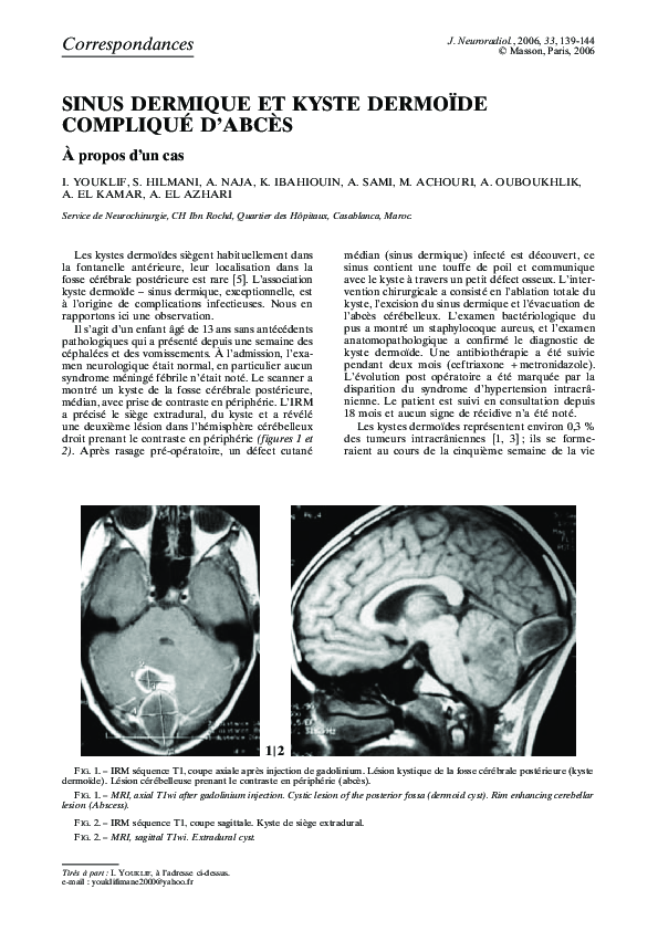 (PDF) Sinus dermique et kyste dermoïde compliqué d’abcès