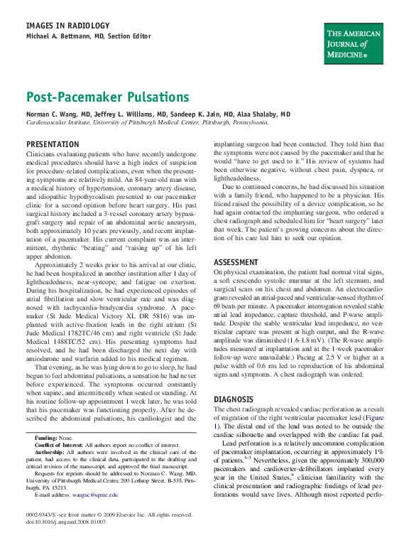 (PDF) Post-Pacemaker Pulsations | Alaa Shalaby - Academia.edu