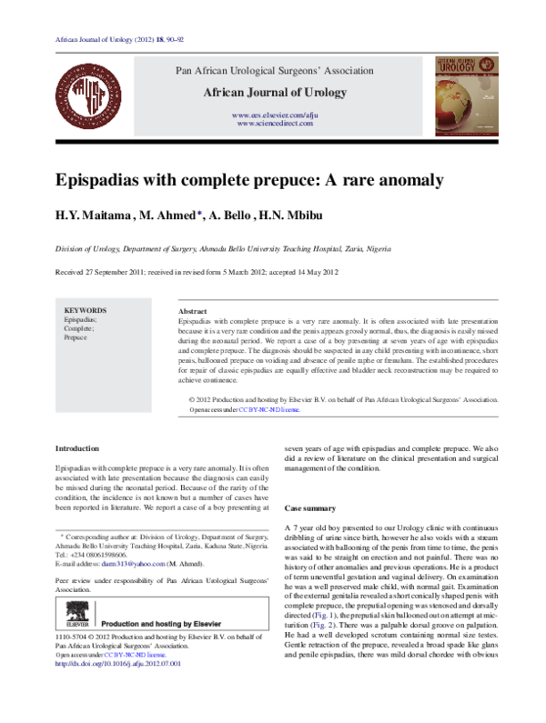 (PDF) Epispadias with complete prepuce: A rare anomaly