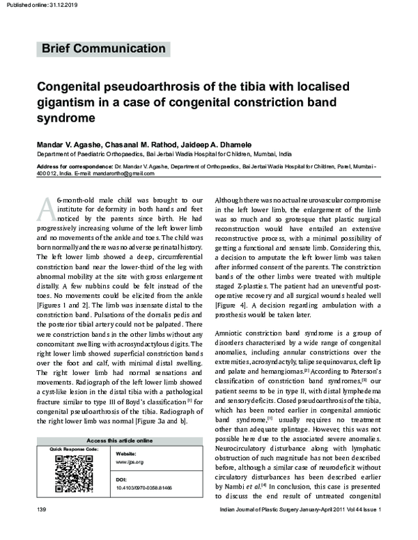 (PDF) Congenital Pseudoarthrosis with Gigantism in a Child