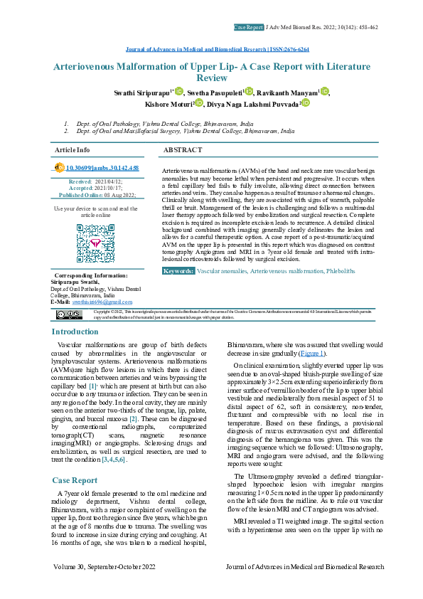 (PDF) Arteriovenous Malformation of Upper Lip-A Case Report with ...