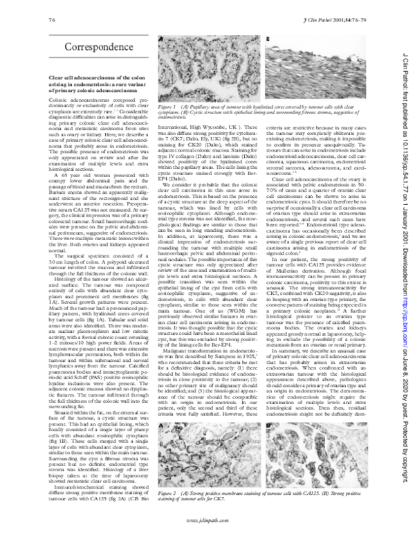 (PDF) Retroperitoneal extraskeletal osteosarcoma | Herman Kroon ...