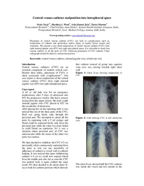(PDF) Central venous catheter malposition into intrapleural space