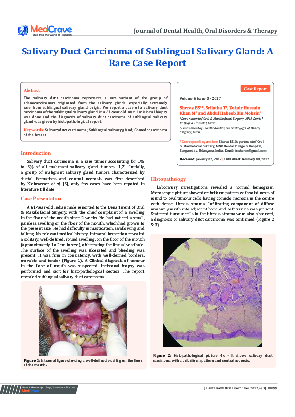 (PDF) Salivary Duct Carcinoma of Sublingual Salivary Gland: A Rare Case ...