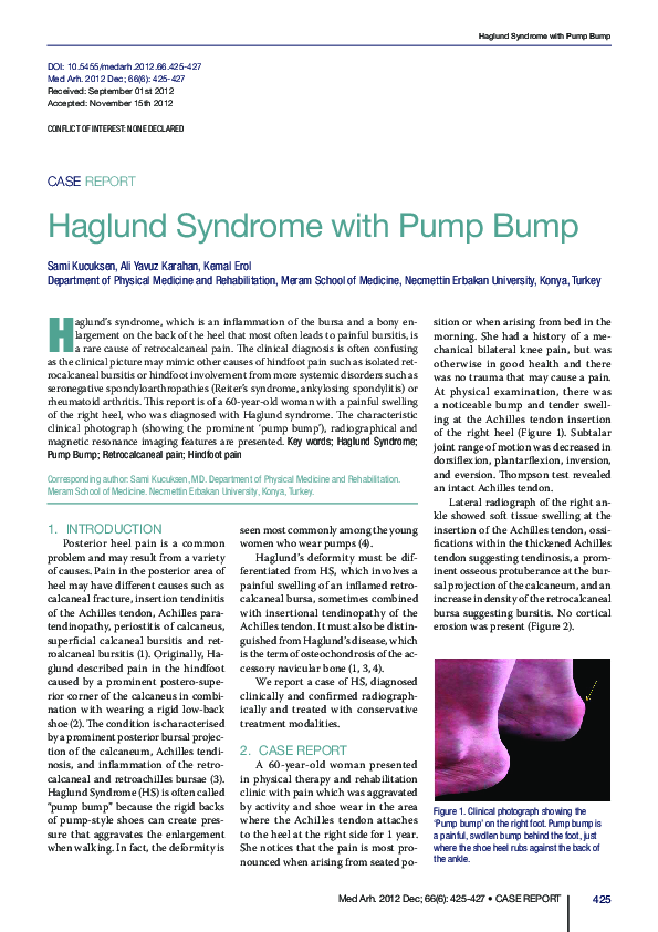 (PDF) Haglund Syndrome with Pump Bump