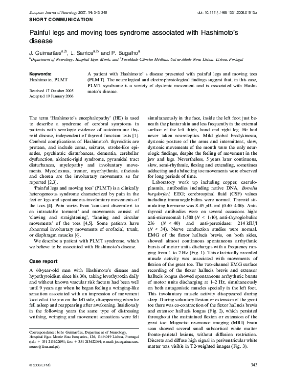 (PDF) Painful legs and moving toes syndrome associated with Hashimoto's ...