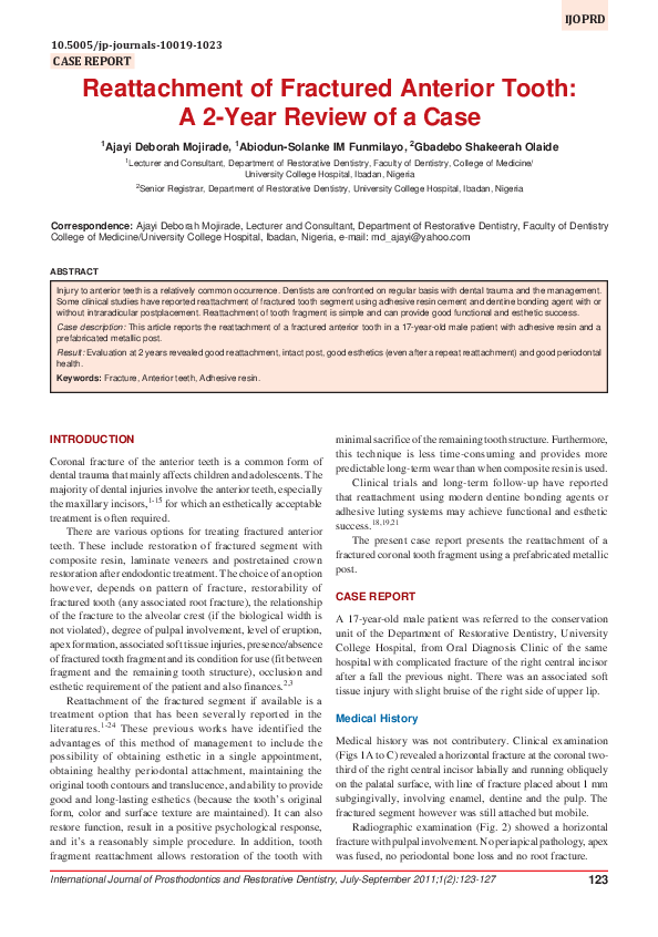 (PDF) Reattachment of Fractured Anterior Tooth: A 2-Year Review of a Case