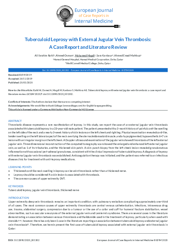 (PDF) Tuberculoid Leprosy with External Jugular Vein Thrombosis: A Case ...