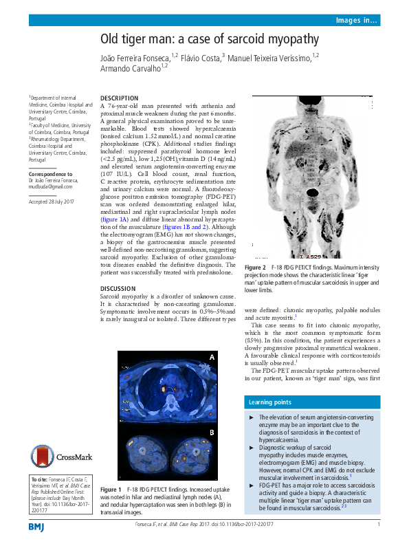 (PDF) Old tiger man: a case of sarcoid myopathy
