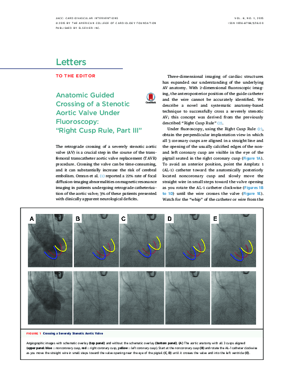 (PDF) Anatomic Guided Crossing of a Stenotic Aortic Valve Under ...