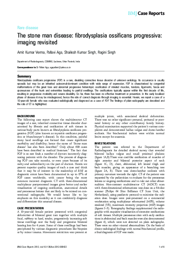 (PDF) The stone man disease: fibrodysplasia ossificans progressiva ...
