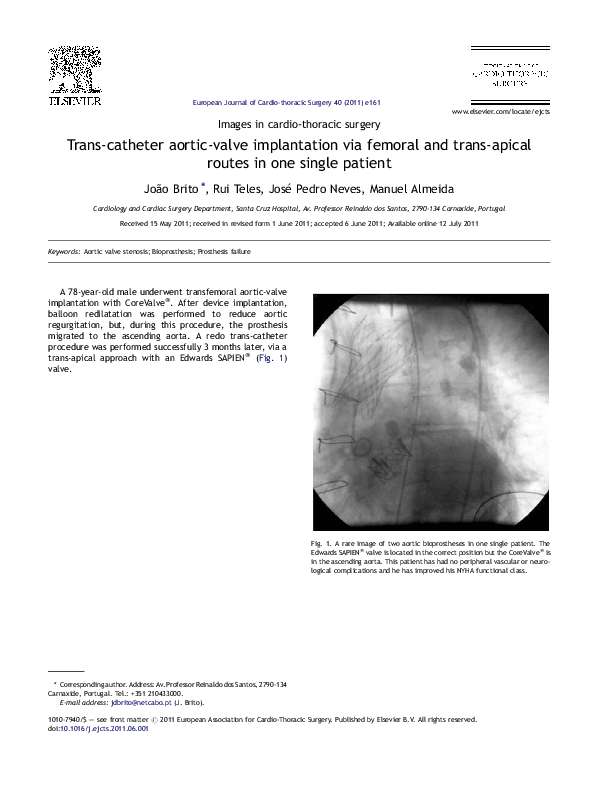 (PDF) Trans-catheter aortic-valve implantation via femoral and trans ...