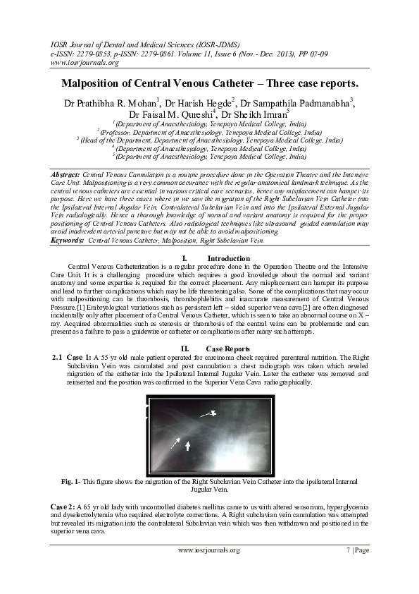 (PDF) Malposition of Central Venous Catheter – Three case reports
