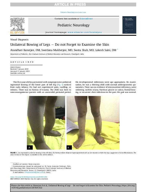 (PDF) Unilateral Bowing of Legs – Do not forget to examine the Skin