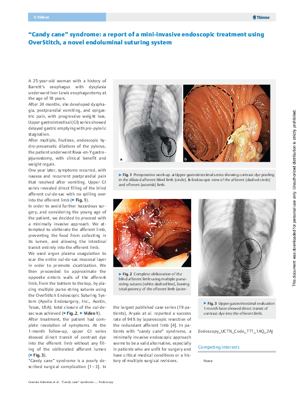 (PDF) “Candy cane” syndrome: a report of a mini-invasive endoscopic ...