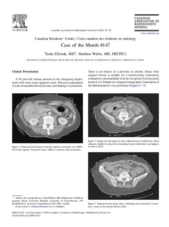 (PDF) Case of the Month #147
