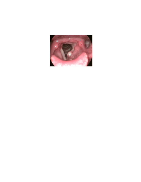 Pdf Formant Analysis In Dysphonic Patients And Automatic Arabic Digit