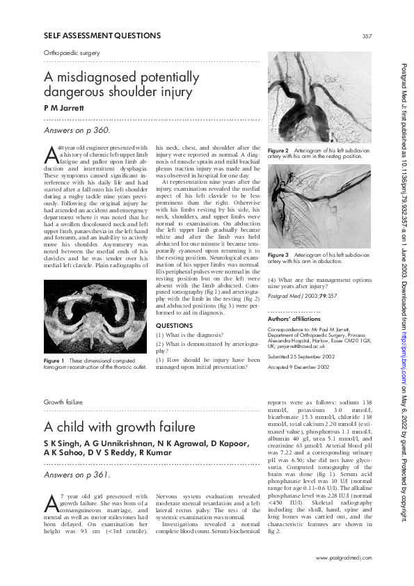 (PDF) A child with growth failure