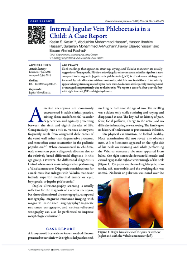(PDF) Internal Jugular Vein Phlebectasia in a Child: A Case Report