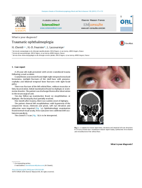 (PDF) Traumatic ophthalmoplegia