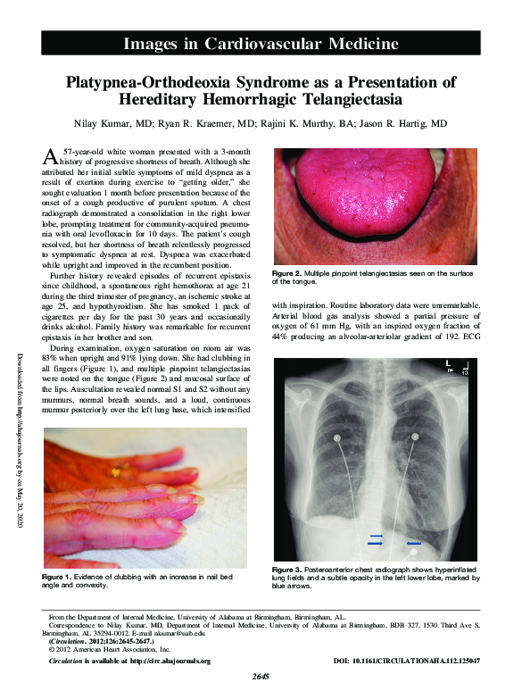 (PDF) Platypnea-Orthodeoxia Syndrome as a Presentation of Hereditary ...