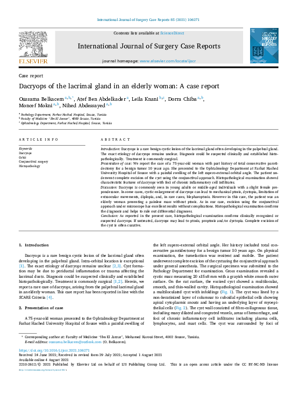 (PDF) Dacryops of the lacrimal gland in an elderly woman: A case report