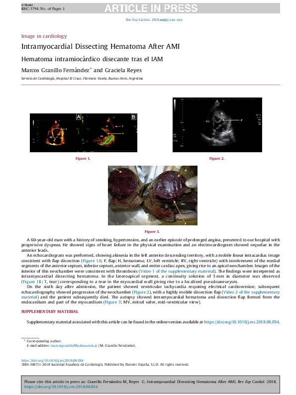 (PDF) Intramyocardial Dissecting Hematoma After AMI