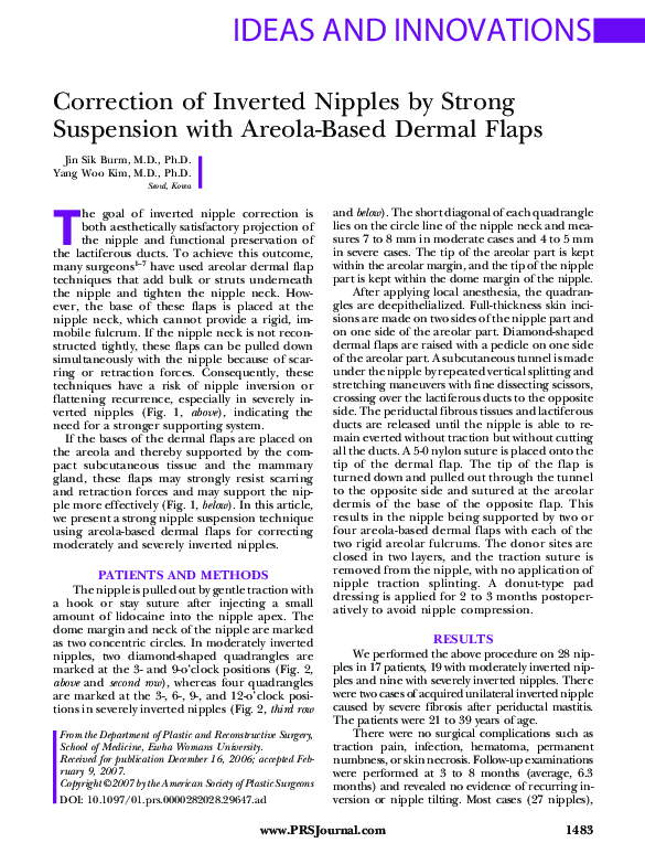 (PDF) Correction of Inverted Nipples by Strong Suspension with Areola ...