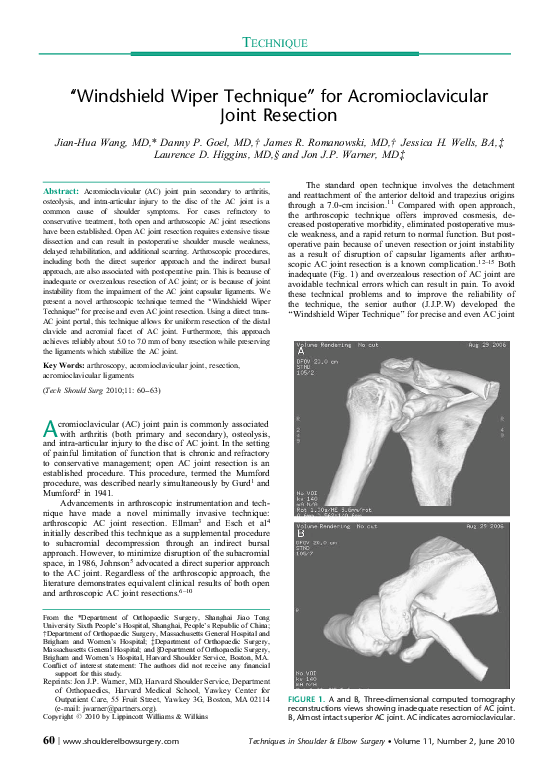 (PDF) “Windshield Wiper Technique” for Acromioclavicular Joint Resection
