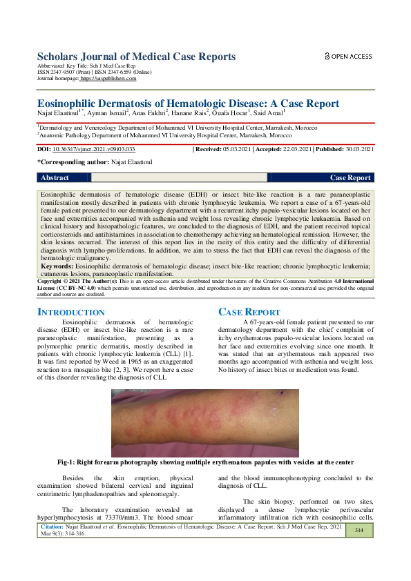 (PDF) Eosinophilic Dermatosis of Hematologic Disease: A Case Report ...