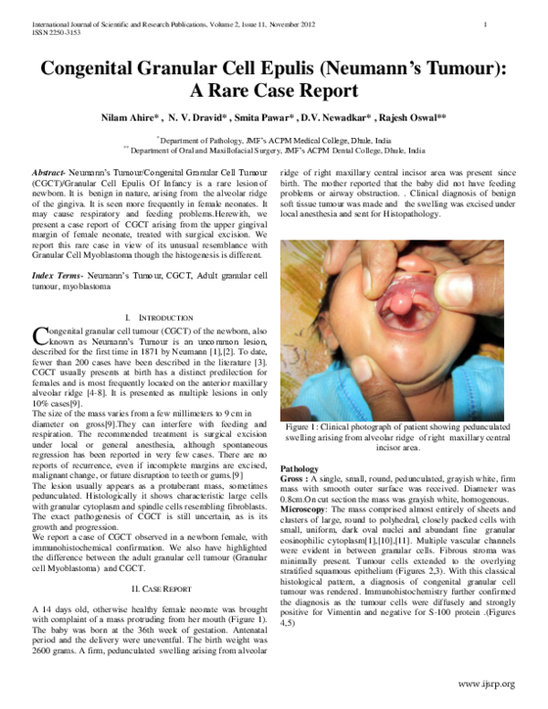 Congenital Epulis Of Newborn Pathology Outlines
