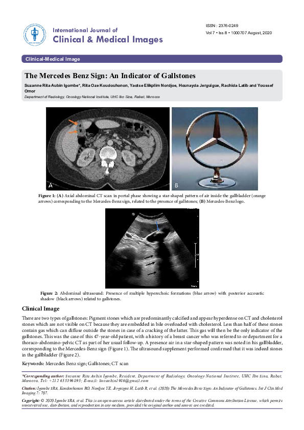 (PDF) The Mercedes Benz Sign: An Indicator of Gallstones | youssef omor ...