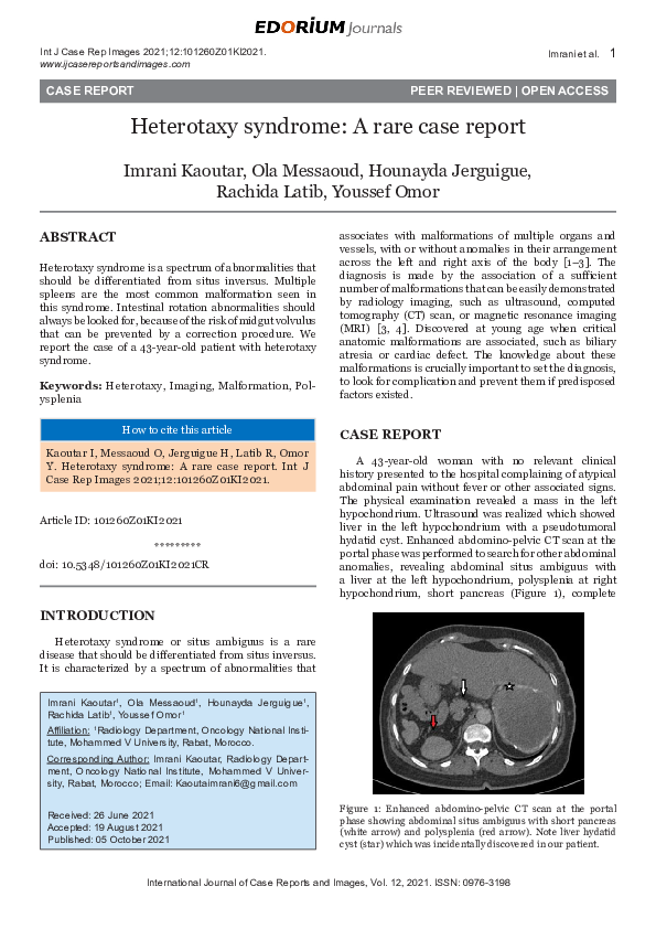 (PDF) Heterotaxy syndrome: A rare case report