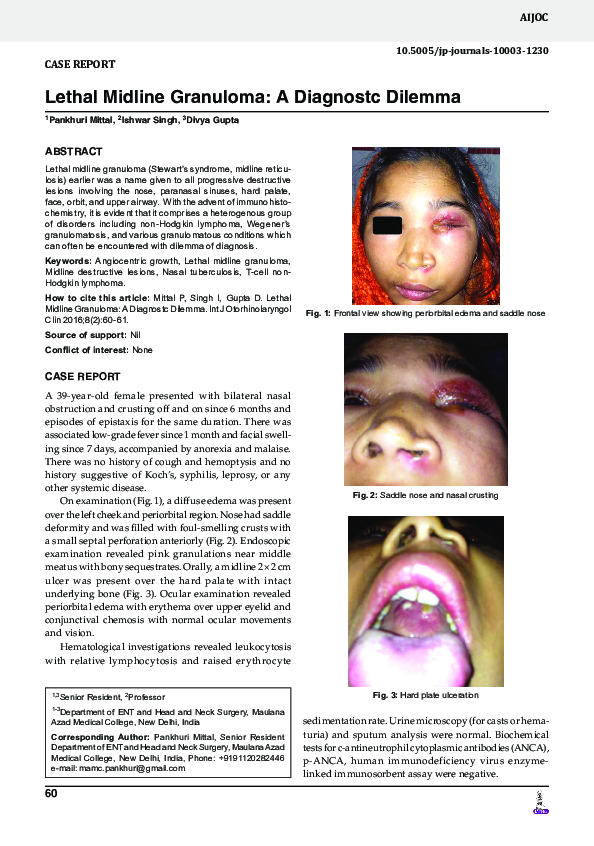 (PDF) Lethal Midline Granuloma: A Diagnostc Dilemma