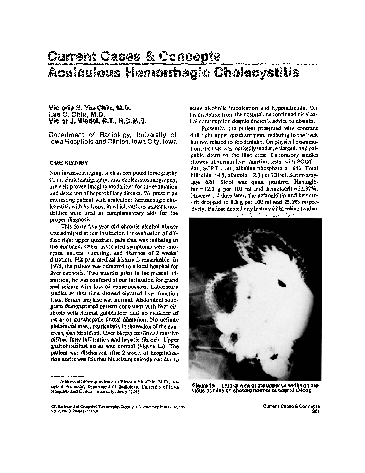 (PDF) Acalculous hemorrhagic cholecystitis