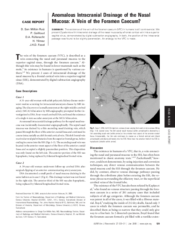 (PDF) Anomalous intracranial drainage of the nasal mucosa: a vein of ...