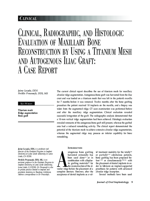 (PDF) Clinical, Radiographic, and Histologic Evaluation of Maxillary ...