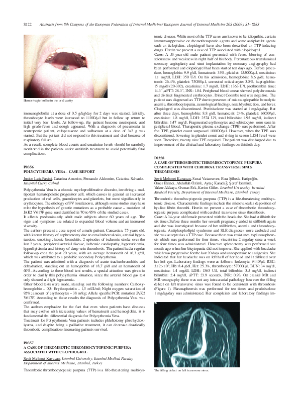 (PDF) P0358 a Case of Thrombotic Thrombocytopenic Purpura Complicated ...