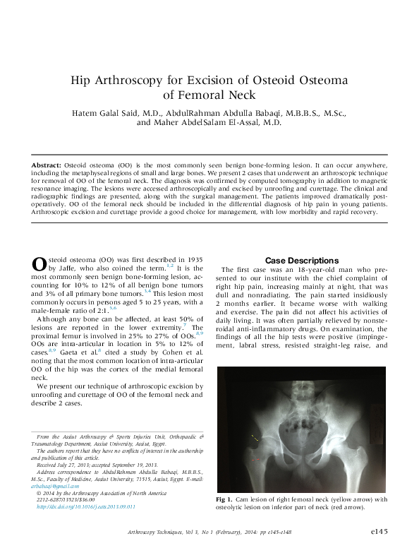 (PDF) Hip Arthroscopy for Excision of Osteoid Osteoma of Femoral Neck ...