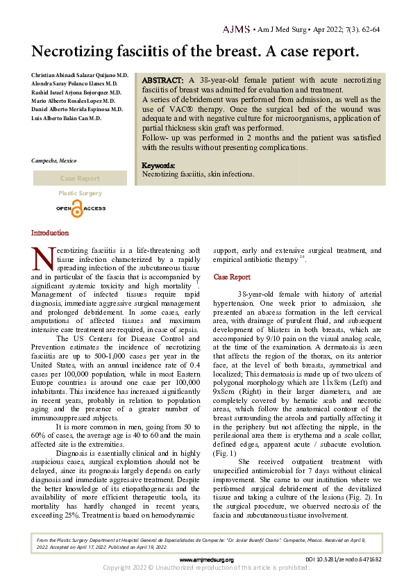 (PDF) Necrotizing fasciitis of the breast. A case report