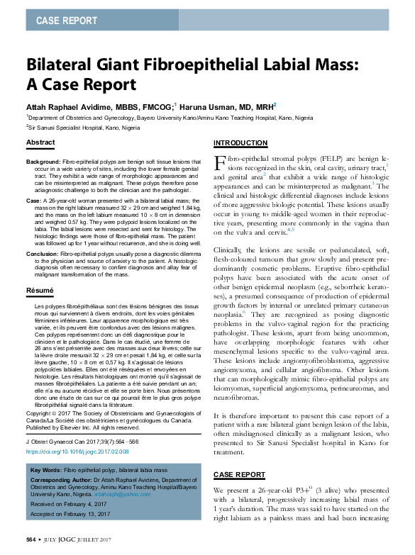(PDF) Bilateral Giant Fibroepithelial Labial Mass: A Case Report