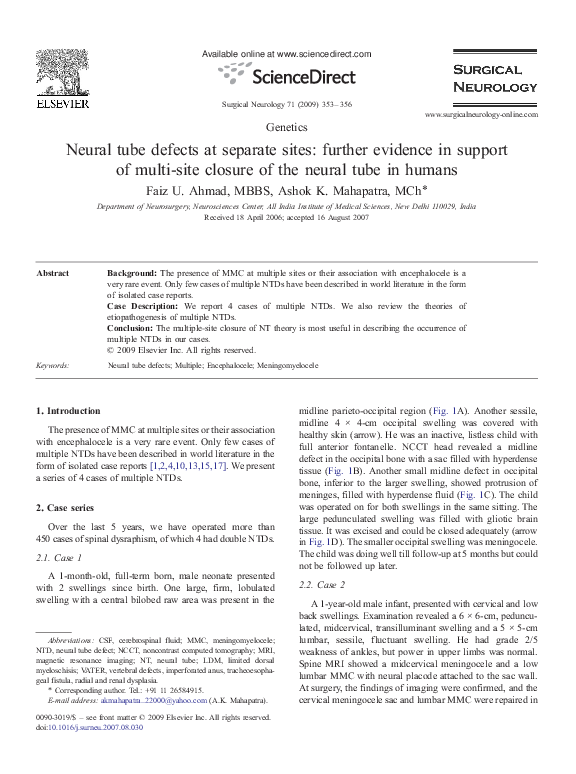 (PDF) Neural tube defects at separate sites: further evidence in ...