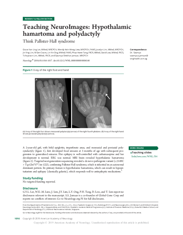 (PDF) Teaching NeuroImages: Hypothalamic hamartoma and polydactyly