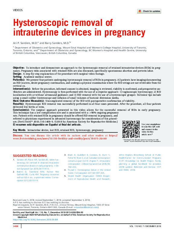 (PDF) Hysteroscopic removal of intrauterine devices in pregnancy