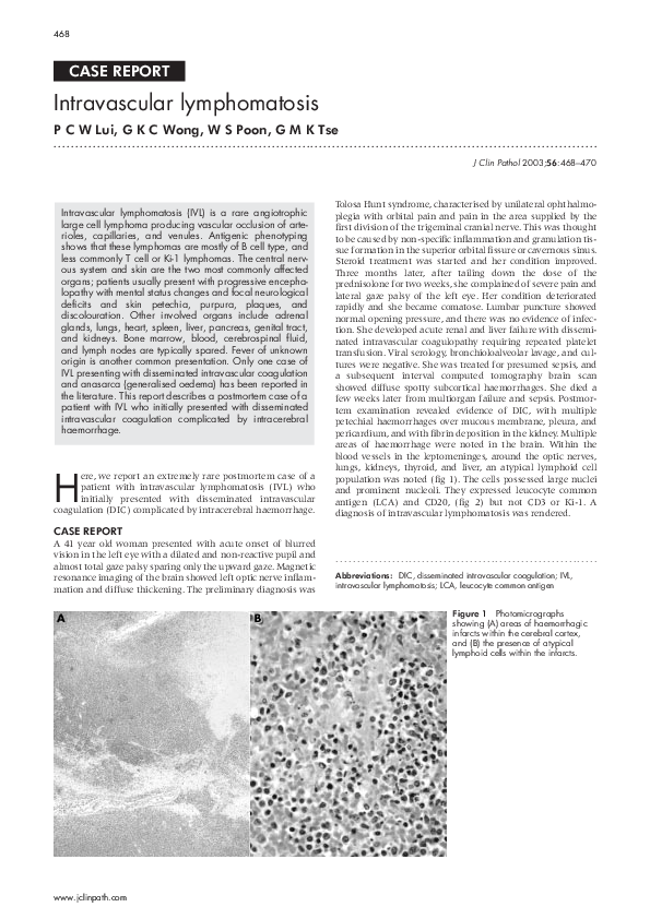 (PDF) Intravascular lymphomatosis