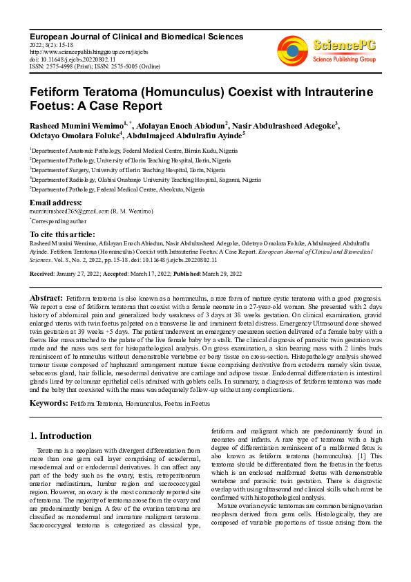 (PDF) Fetiform Teratoma (Homunculus) Coexist with Intrauterine Foetus ...